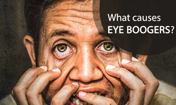 Facts About Eye Boogers That You Didn't Know