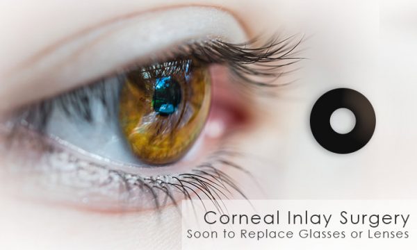 Corneal-Inlay-Surgery-Soon-to-Replace-Glasses-or-Lenses