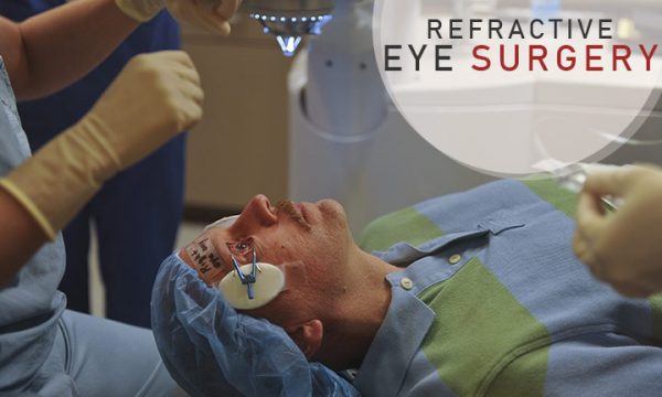 Refractive-eye-surgery